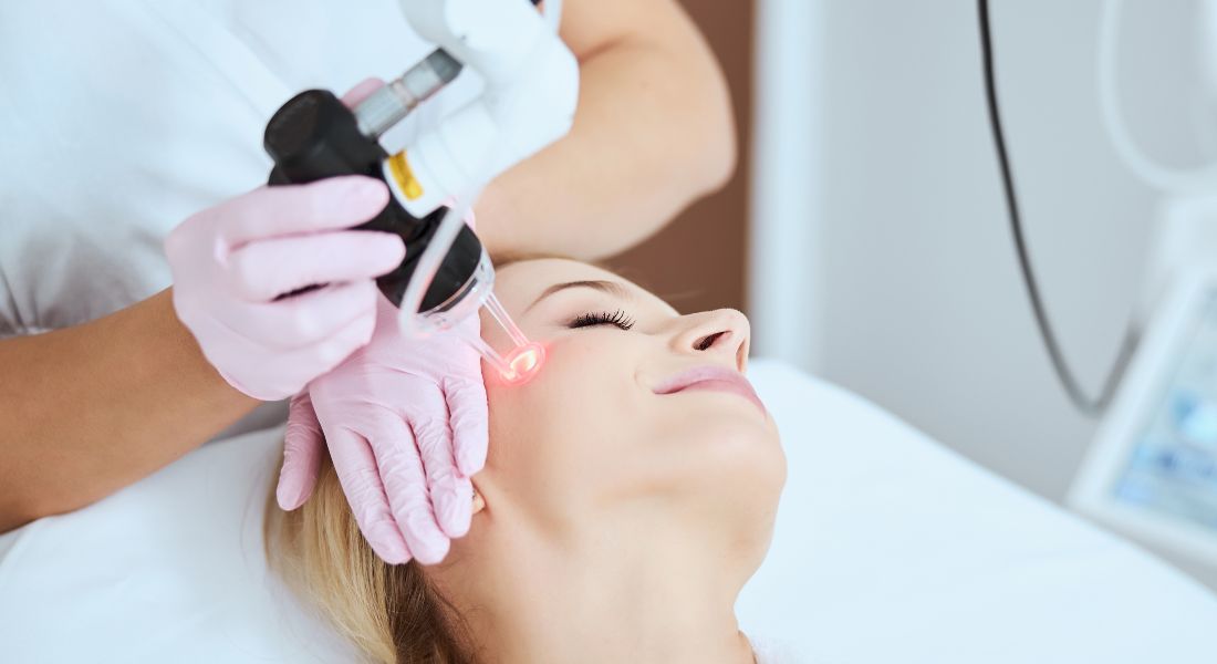 CO2 Laser for PIH (Safety & Treatment Guide)